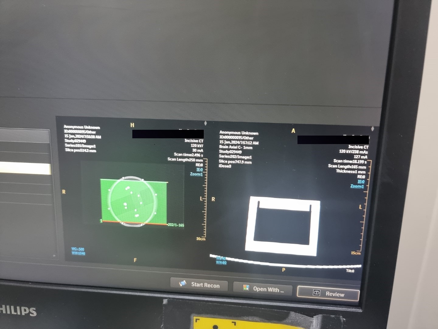 Philips Incisive 128 Slice EX3522 - EverX | Used Medical Imaging ...