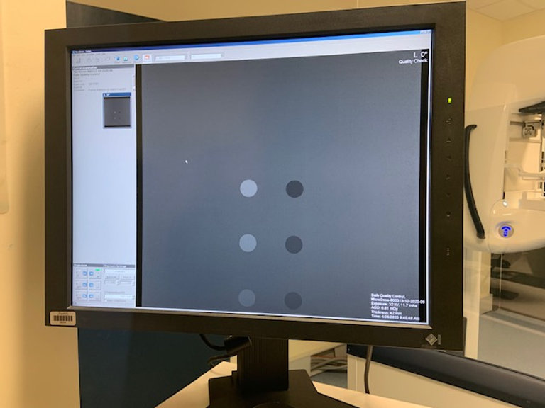 Philips Sectra L30 MicroDose Digital - EX1875 - EverX | Used Medical ...